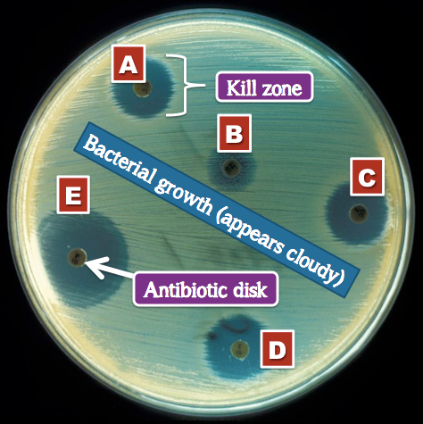 Bacteria: Control and Benefits – Easy Peasy All-in-One High School